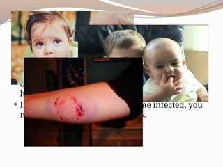 Physical Education 4 - BITES and POISONING.pptx