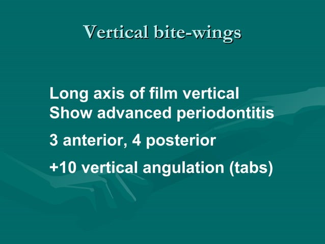 Bite-wing and technique errors lecture1 | PPT