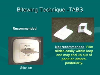Bite-wing and technique errors lecture1 | PPT