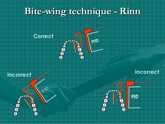Bite-wing and technique errors lecture1