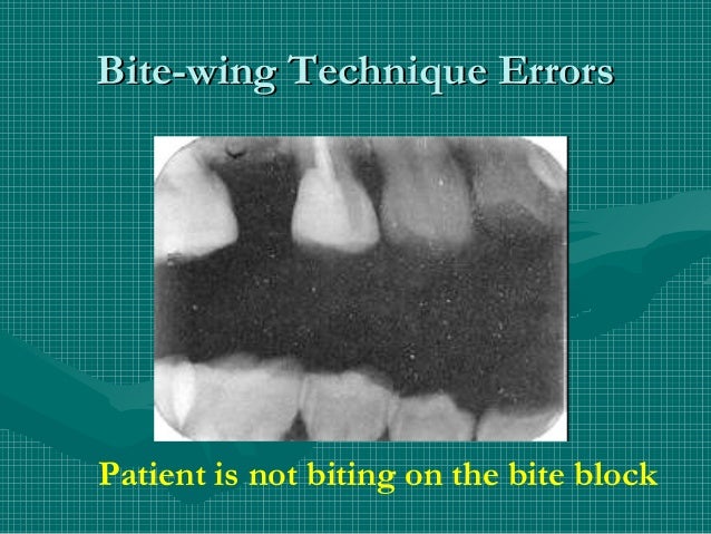 Bite-wing and technique errors lecture1