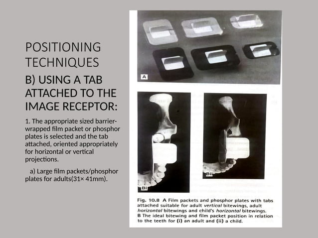 bitewing rad.pptx, definition, techniques | PPTX