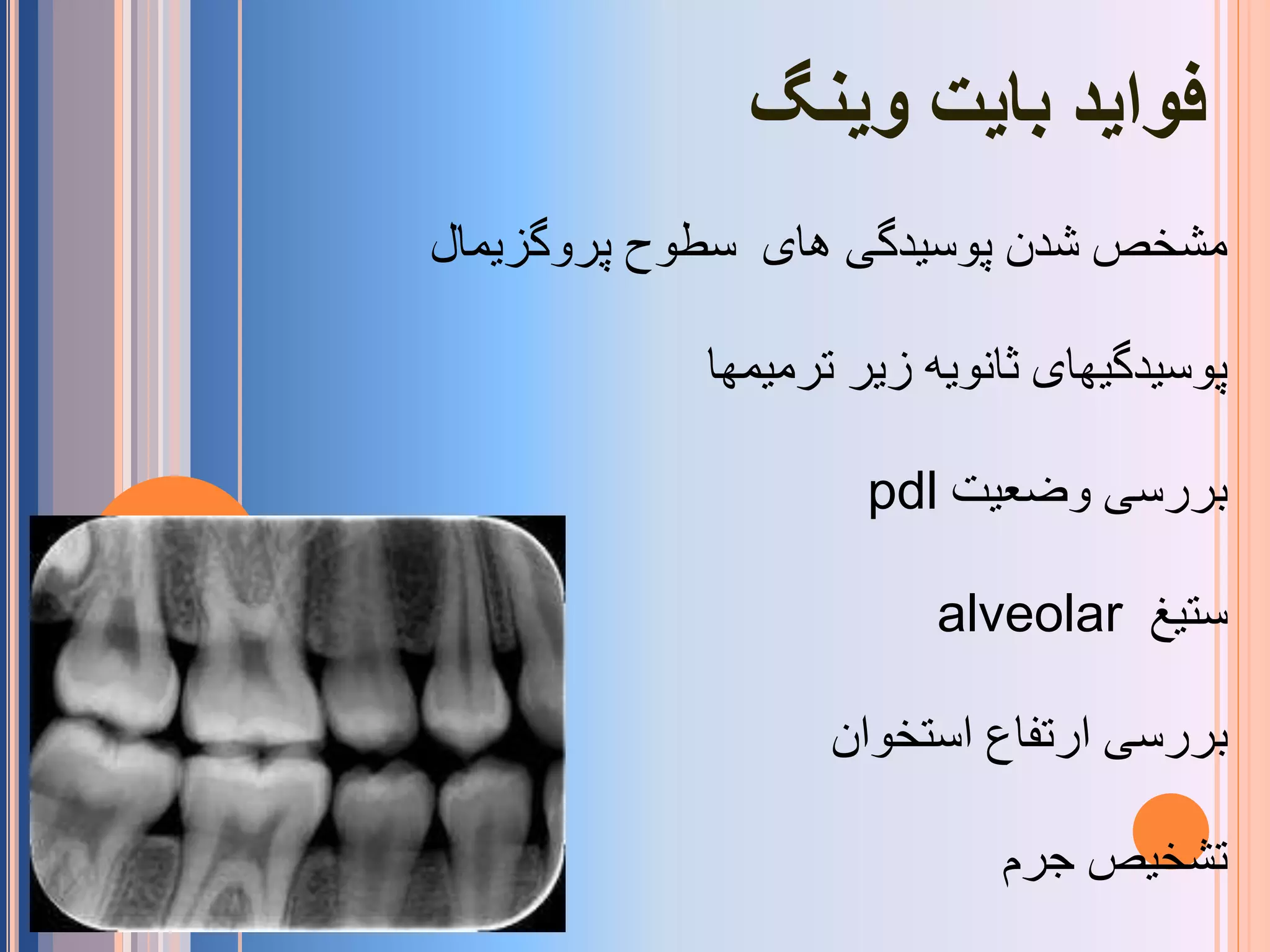 Bitewing&occlusal radiographic technique | PPTX
