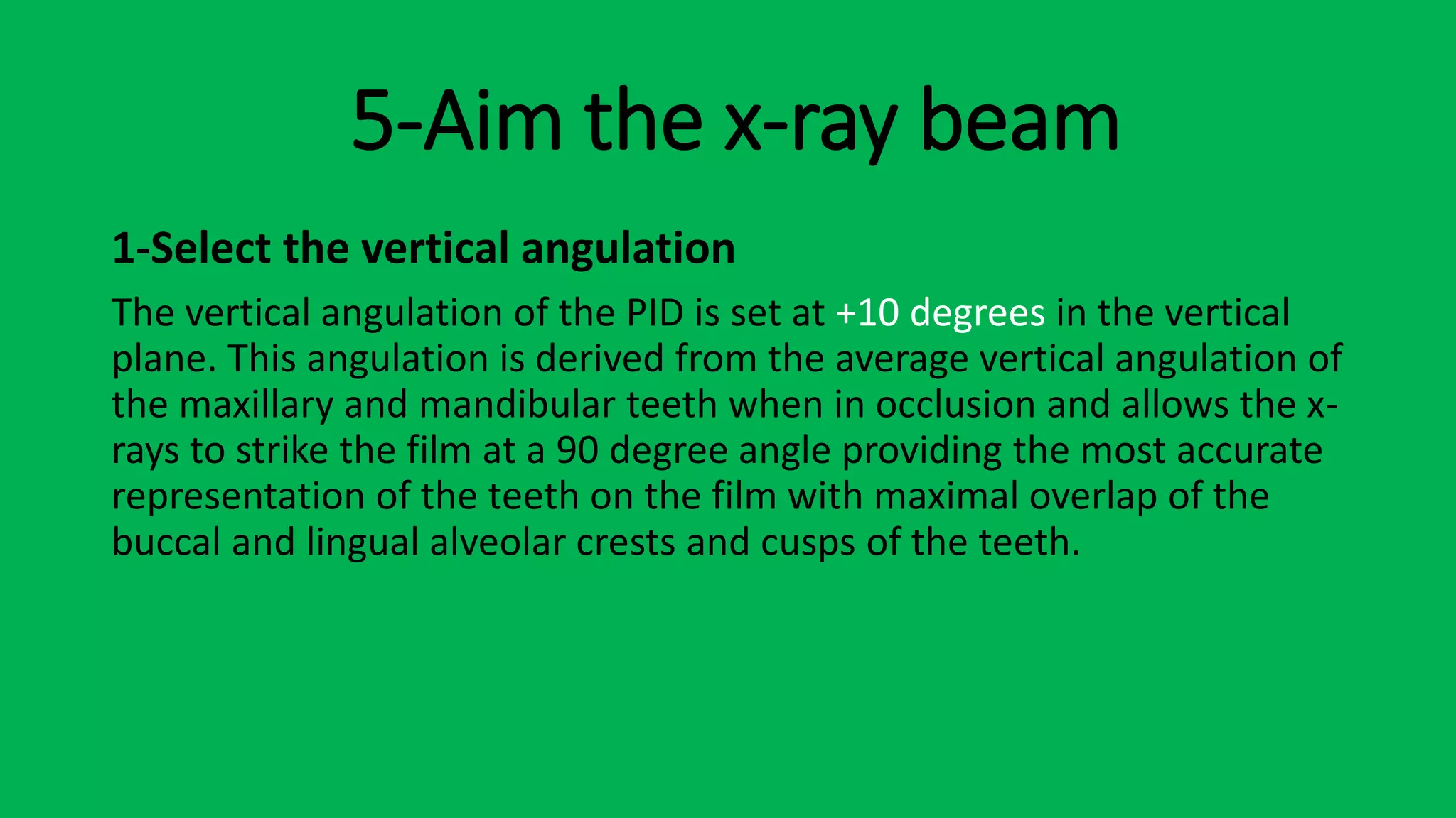 Bitewing radiographry | PPTX