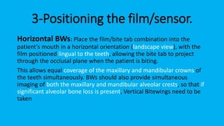 Bitewing radiographry | PPTX