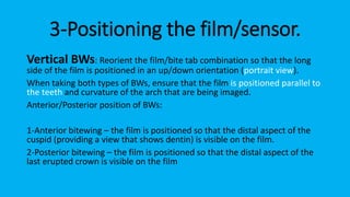 Bitewing radiographry | PPTX