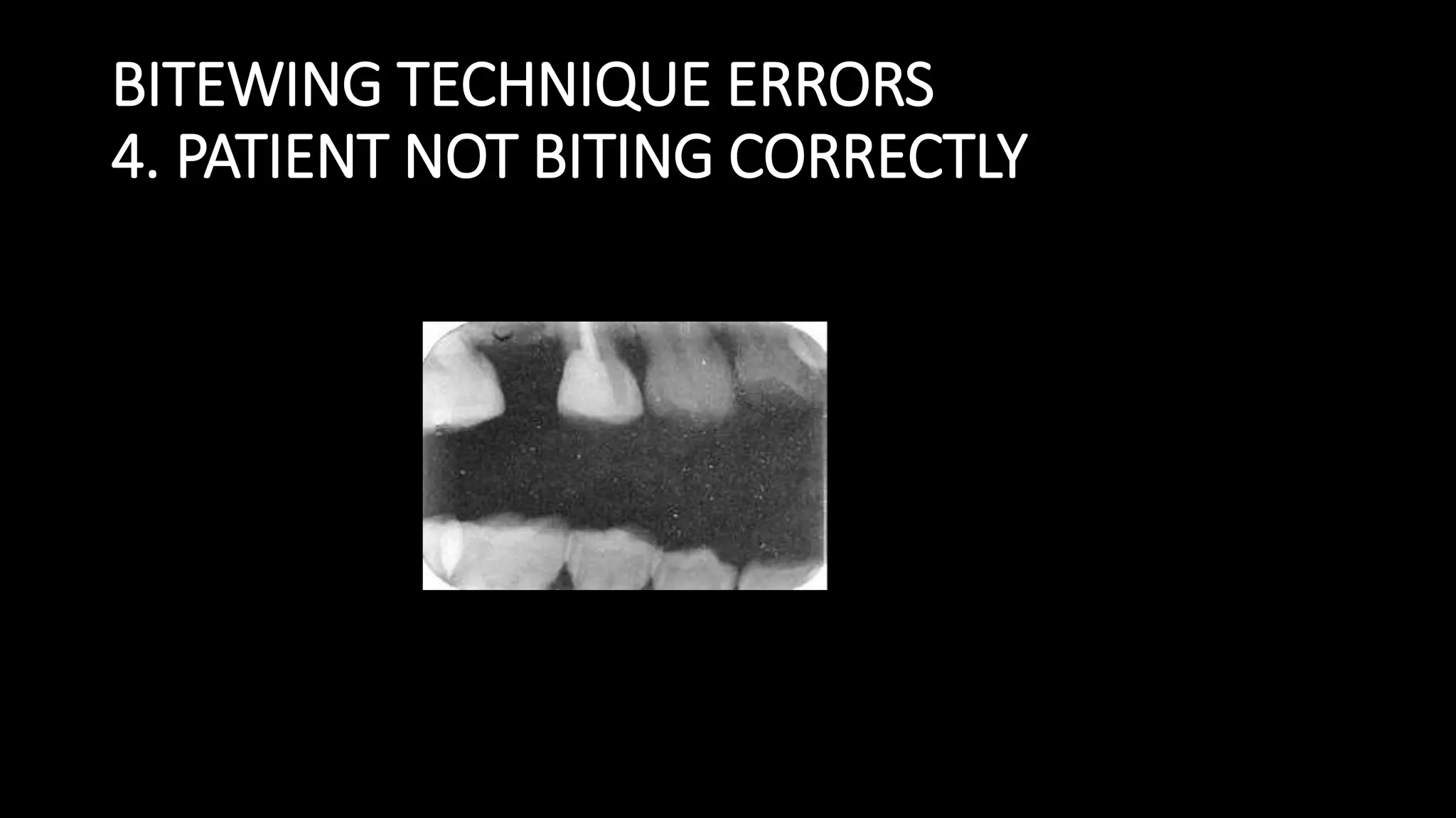 Dental radiology-BITEWING RADIOGRAPHY - Copy.pptx