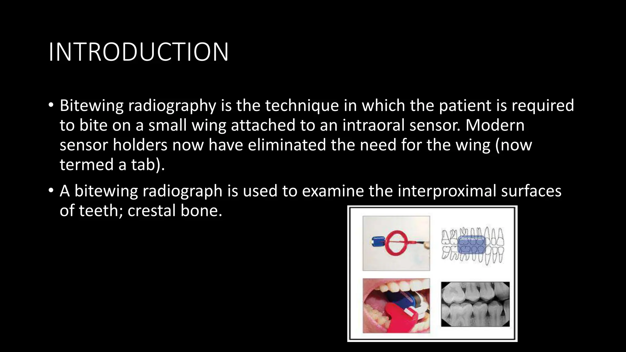 Dental radiology-BITEWING RADIOGRAPHY - Copy.pptx
