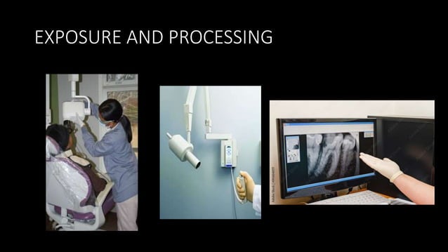 Dental radiology-BITEWING RADIOGRAPHY - Copy.pptx