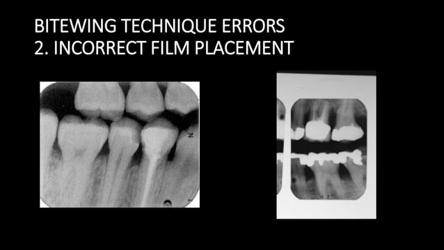Dental radiology-BITEWING RADIOGRAPHY - Copy.pptx