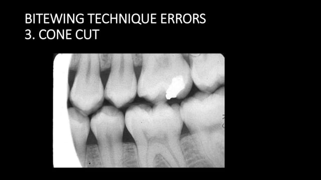 Dental radiology-BITEWING RADIOGRAPHY - Copy.pptx