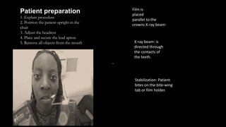 Dental radiology-BITEWING RADIOGRAPHY - Copy.pptx