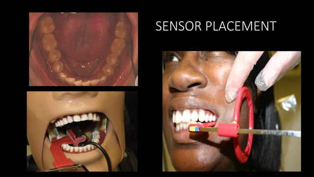 Dental radiology-BITEWING RADIOGRAPHY - Copy.pptx