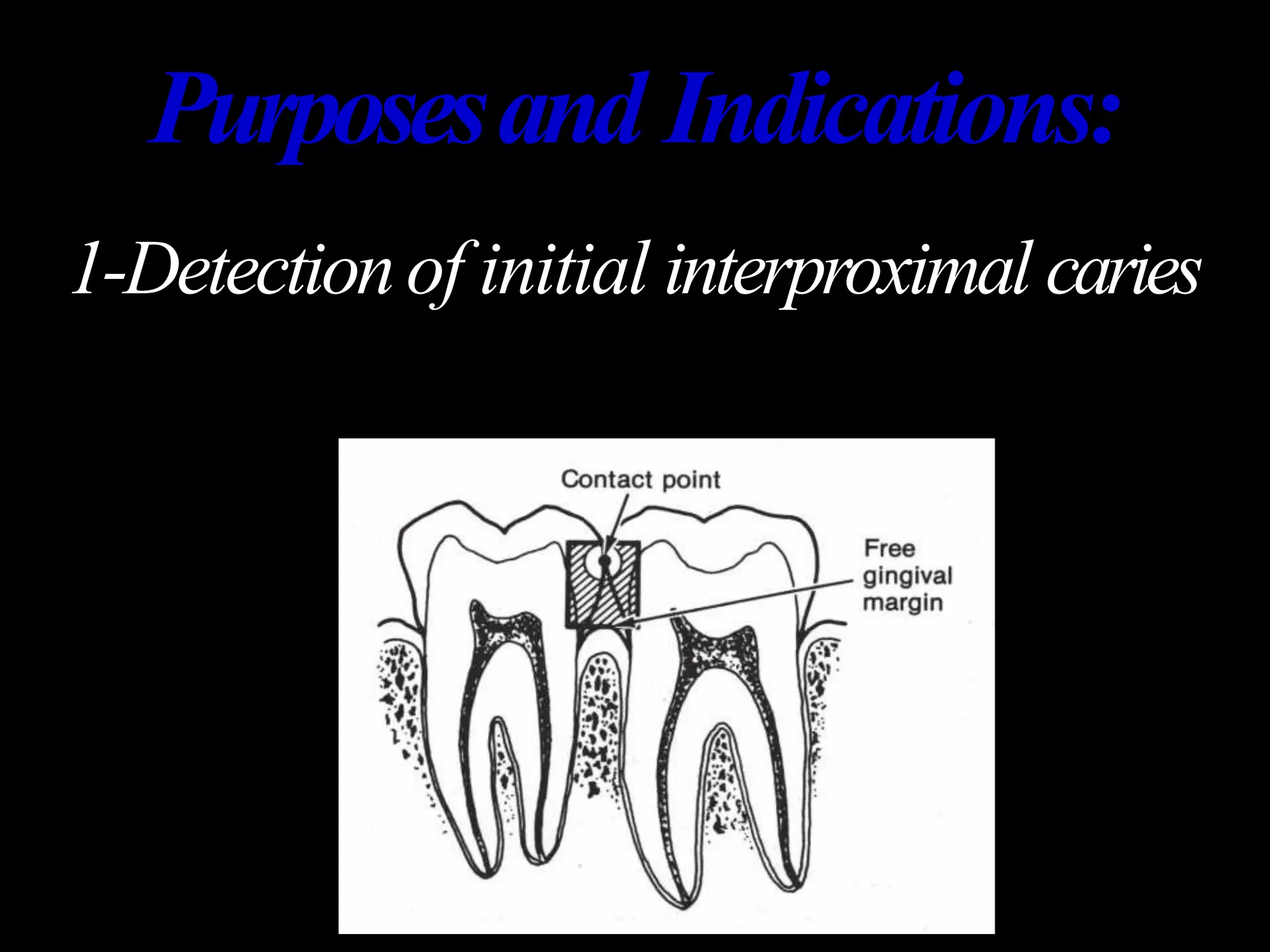 Bitewing Technique.pptx
