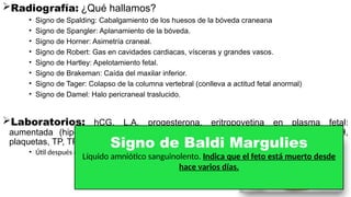 ÓBITOO FETAL, PRINCIPALES ASPECTOS A CONOCER | PPTX