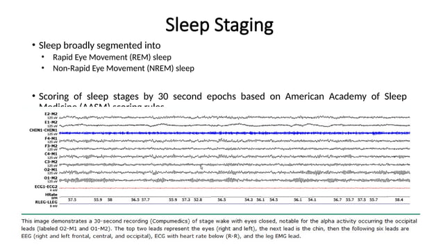 Normal Sleep Physiology in medicine.pptx