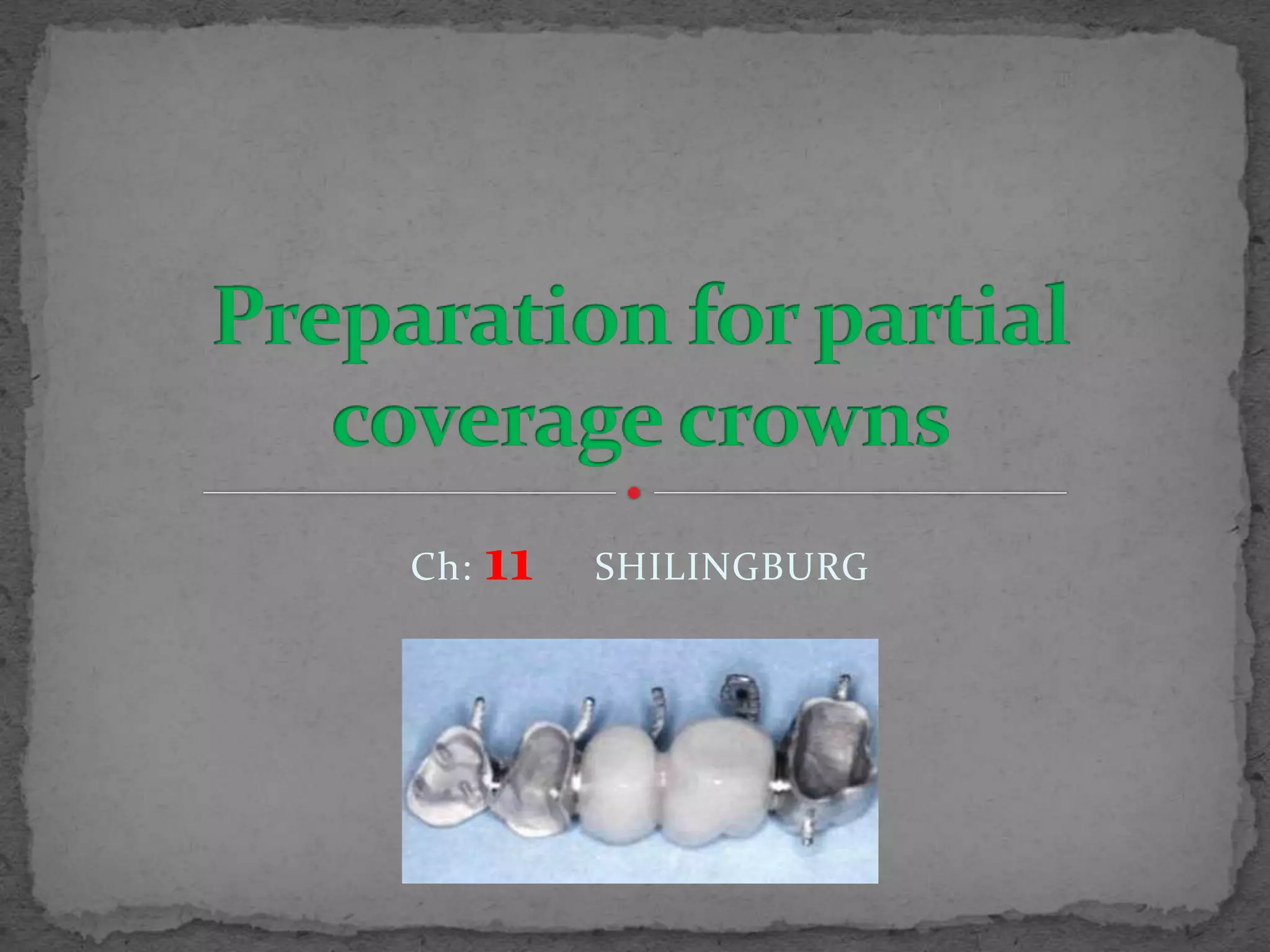 preparation for partial coverage crowns | PPTX