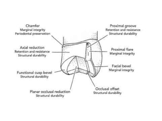 preparation for partial coverage crowns | PPTX