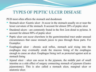 Bi-weekly presentation;peptic ulcer diseases | PPTX