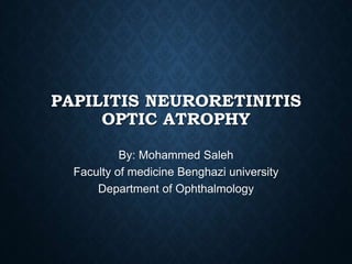 papilitis.pptx