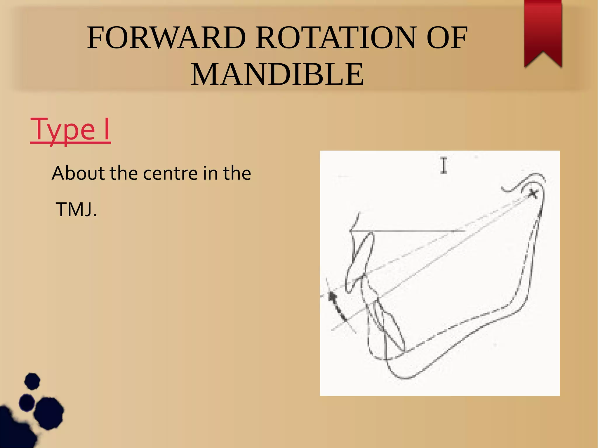 Bjorks analysis | ODP
