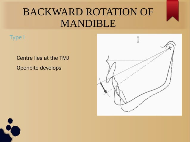 Bjorks analysis | ODP