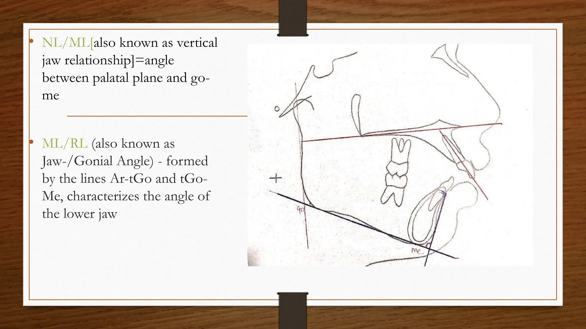 BJORKS CEPHALOMETRIC ANALYSIS. ORTHODONTICS pptx | PPTX