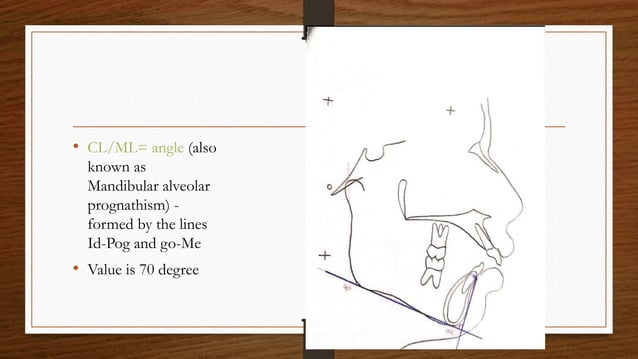 BJORKS CEPHALOMETRIC ANALYSIS. ORTHODONTICS pptx | PPTX