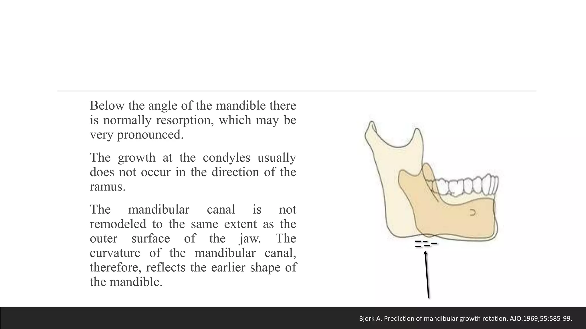 Bjork’s Concept of Jaw Rotation | PPTX