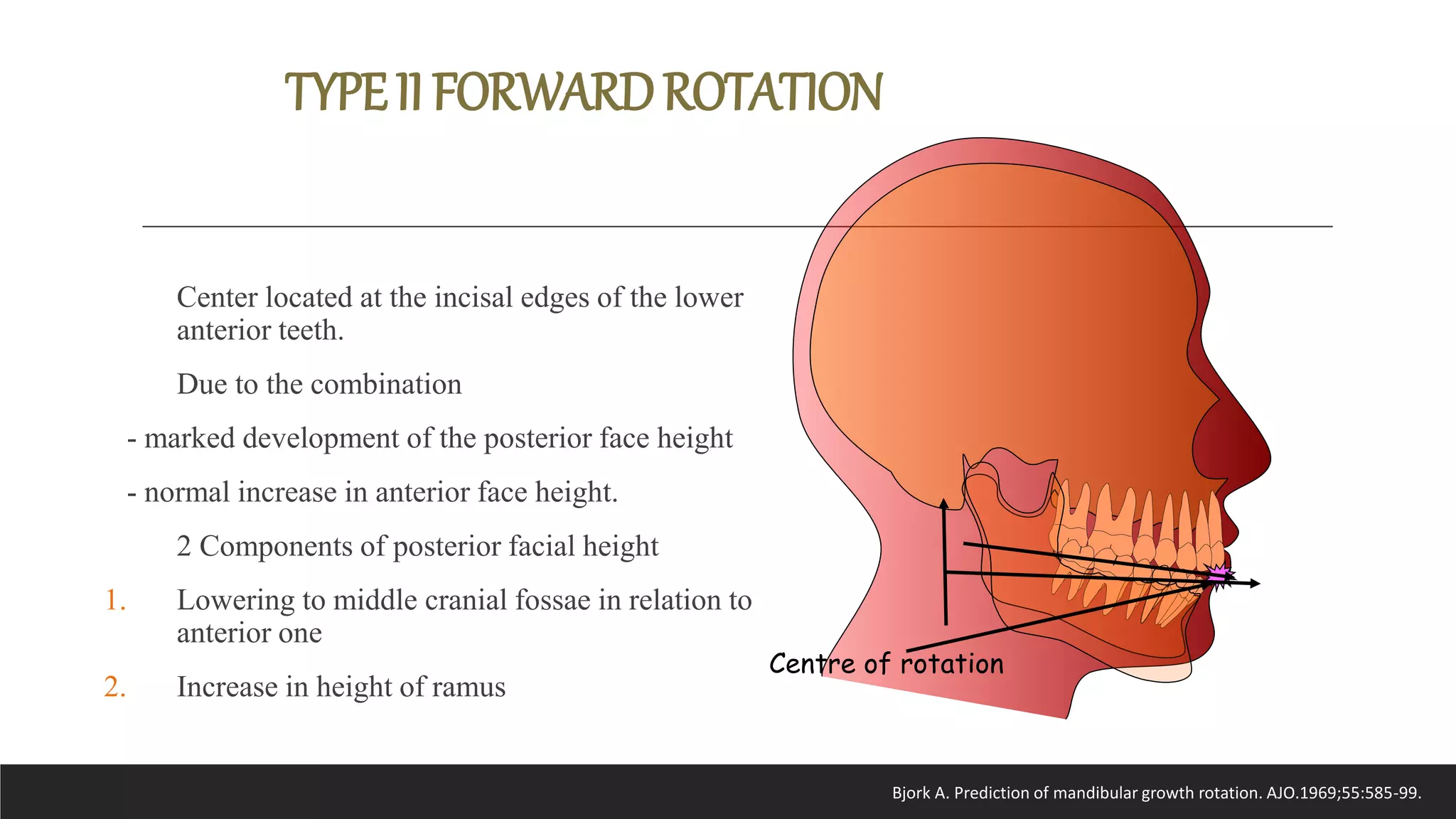 Bjork’s Concept of Jaw Rotation | PPTX