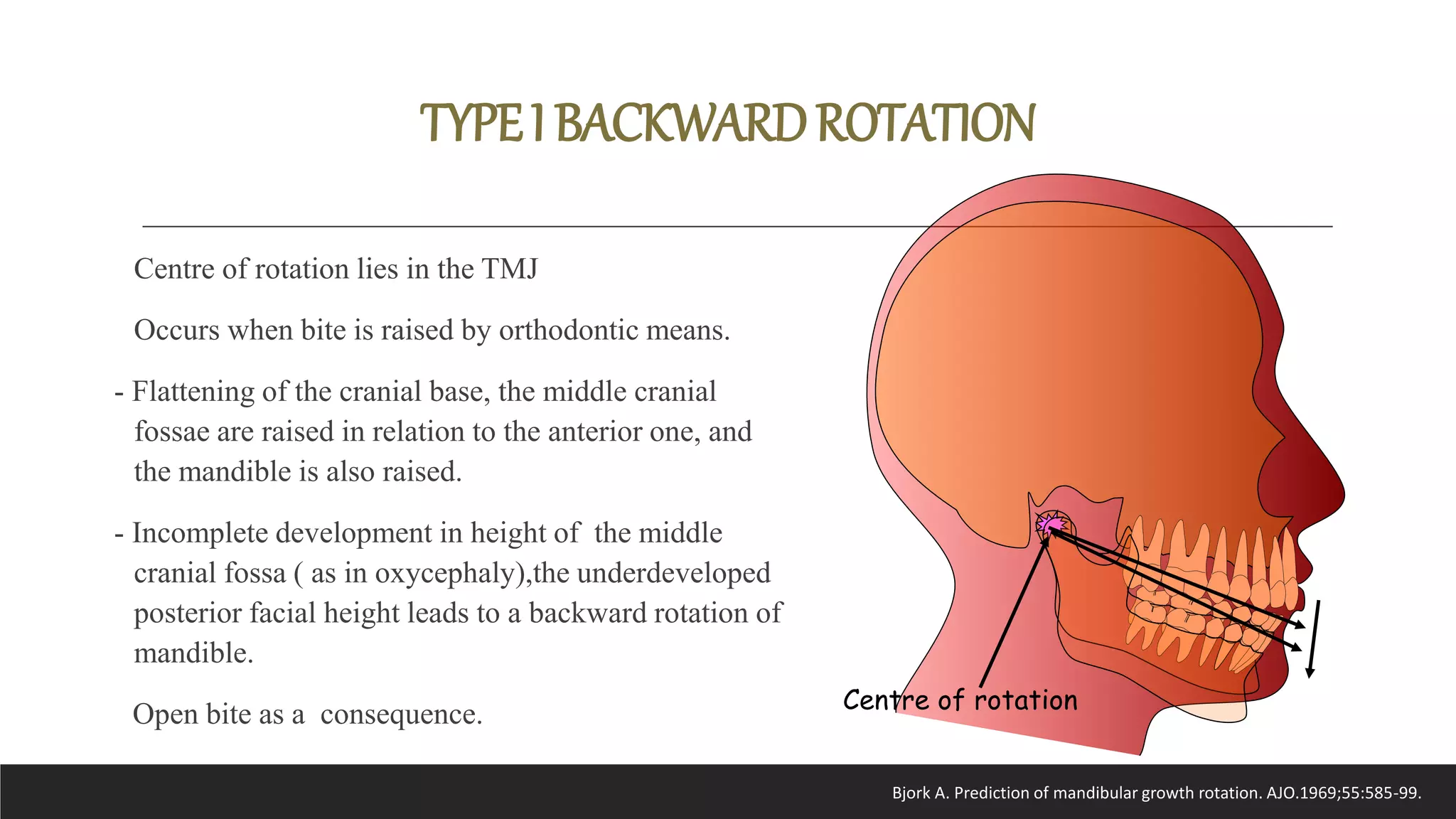 Bjork’s Concept of Jaw Rotation | PPTX