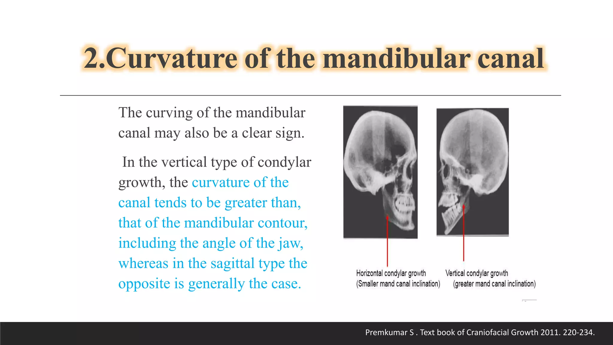 Bjork’s Concept of Jaw Rotation | PPTX