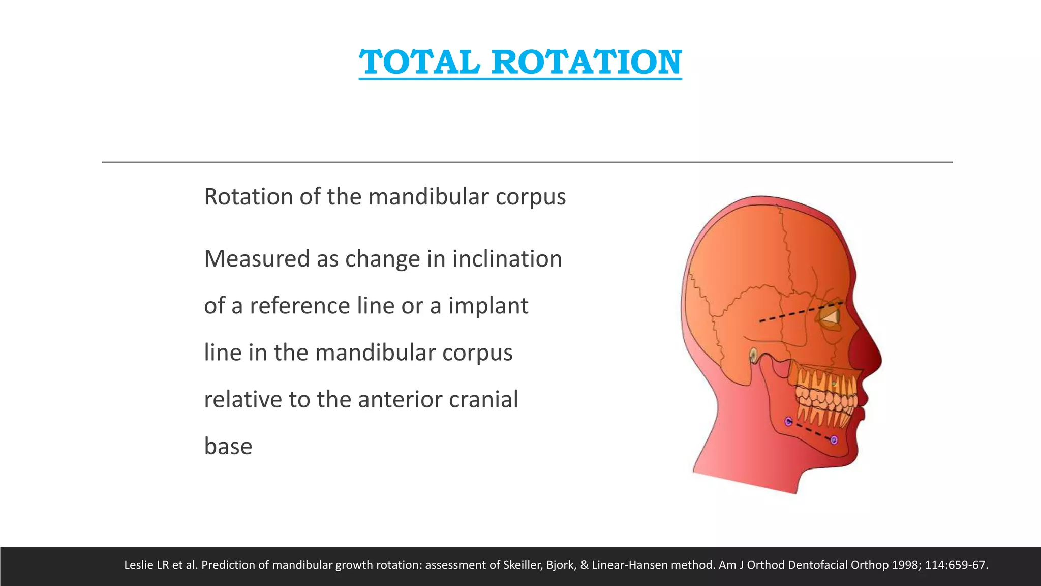 Bjork’s Concept of Jaw Rotation | PPTX