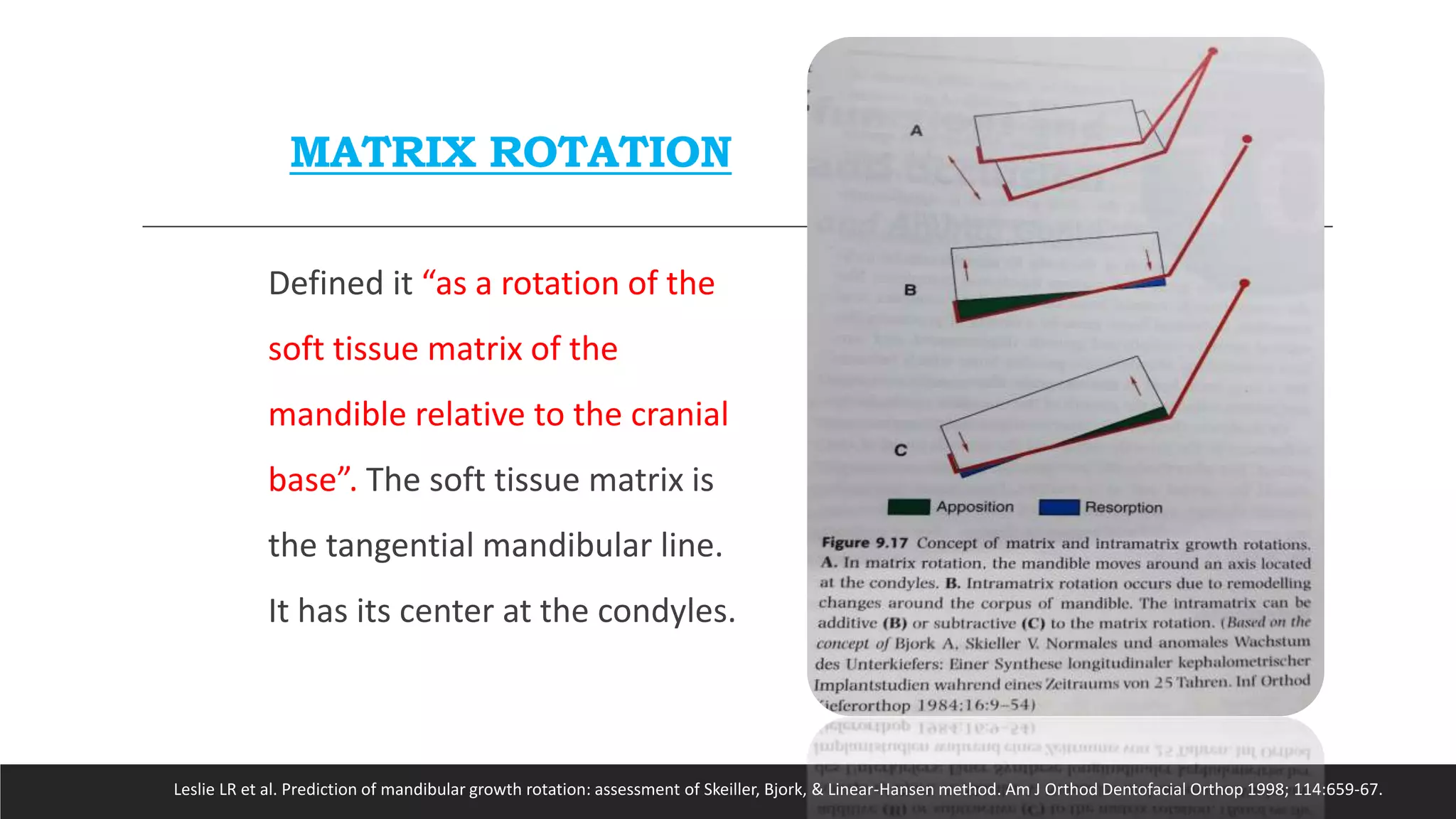 Bjork’s Concept of Jaw Rotation | PPTX