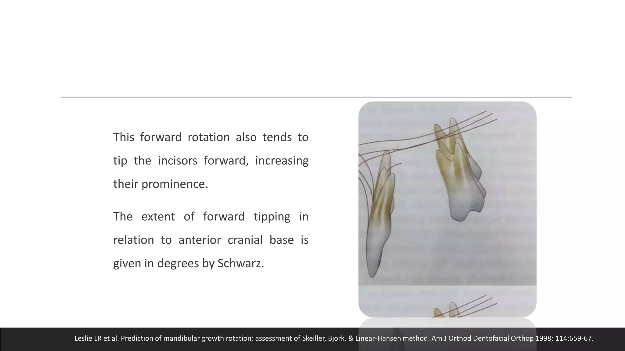 Bjork’s Concept of Jaw Rotation | PPTX