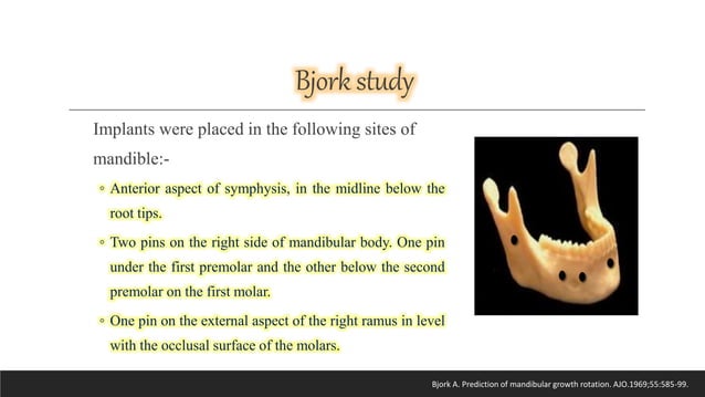 Bjork’s Concept of Jaw Rotation | PPTX | Bone and Joint Conditions ...