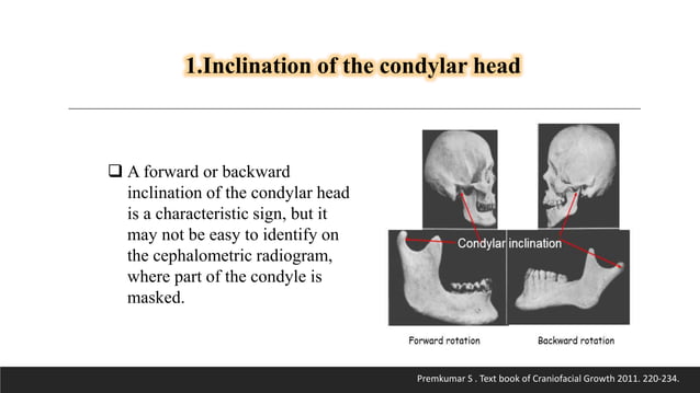 Bjork’s Concept of Jaw Rotation | PPTX | Bone and Joint Conditions ...