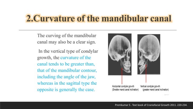 Bjork’s Concept of Jaw Rotation | PPTX | Bone and Joint Conditions ...