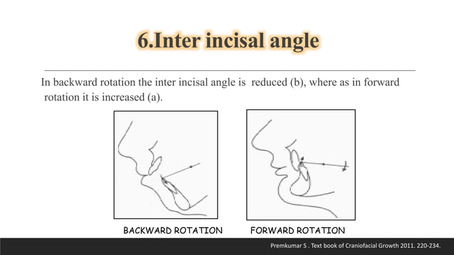 Bjork’s Concept of Jaw Rotation | PPTX | Bone and Joint Conditions ...