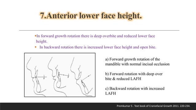 Bjork’s Concept of Jaw Rotation | PPTX | Bone and Joint Conditions ...