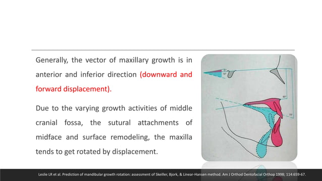 Bjork’s Concept of Jaw Rotation | PPTX | Bone and Joint Conditions ...