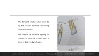 Bjork’s Concept of Jaw Rotation | PPTX