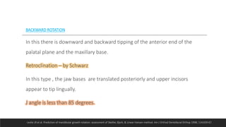 Bjork’s Concept of Jaw Rotation | PPTX