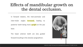 Bjork’s Concept of Jaw Rotation | PPTX
