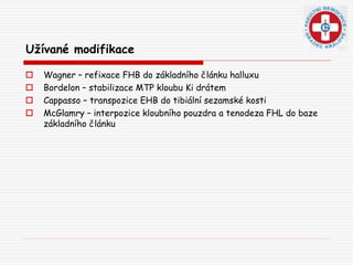 Kellerova resekční arthroplastika | PPTX