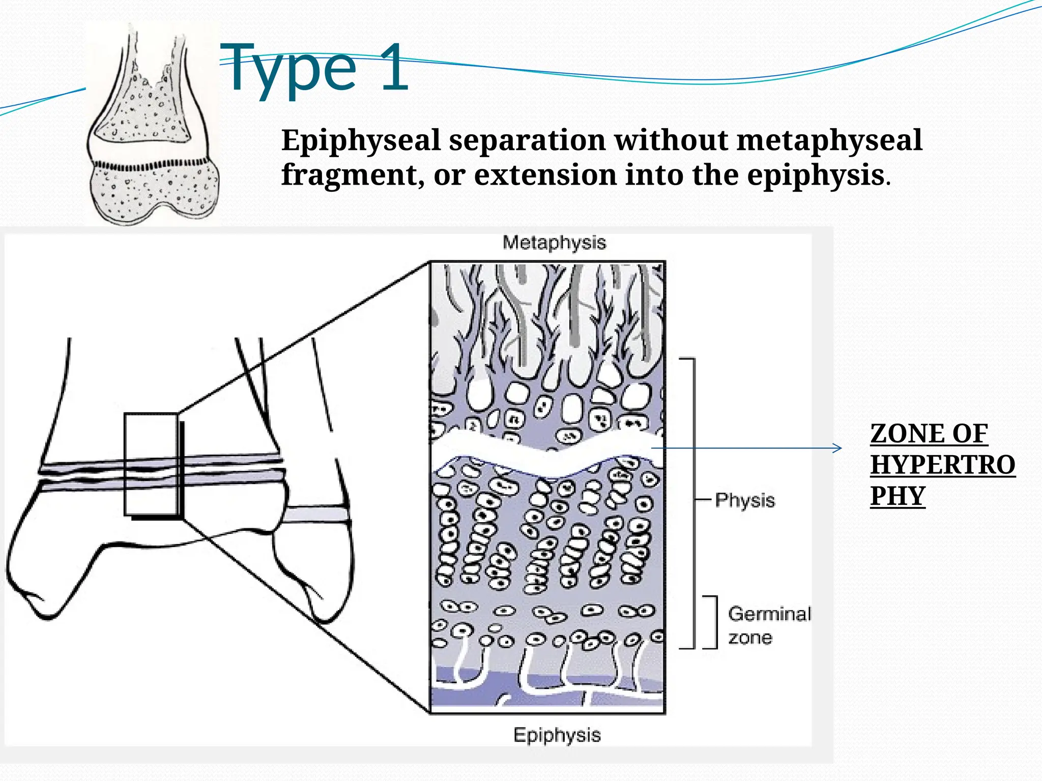 BKK EPIPHYSEAL INJURIES IN CHILDREN- Copy.pptx