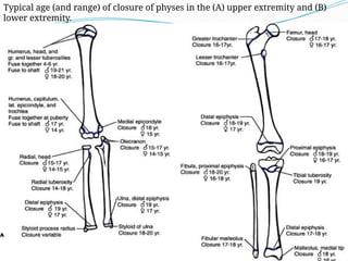 BKK EPIPHYSEAL INJURIES IN CHILDREN- Copy.pptx