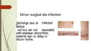 Wound infection, cause, management, postoperative | PPTX