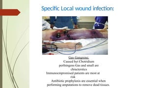 Wound infection, cause, management, postoperative | PPTX