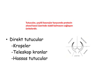 Bükme kroşeler | PPTX